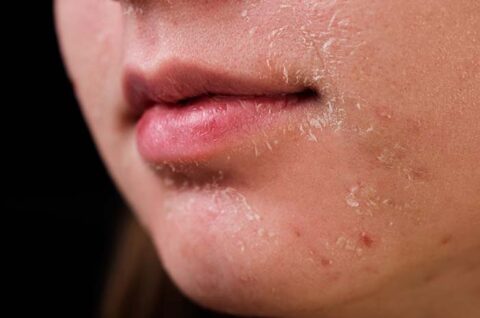 Jenis Kulit Wajah: Normal, Berminyak, Kering, Kombinasi, dan Sensitif